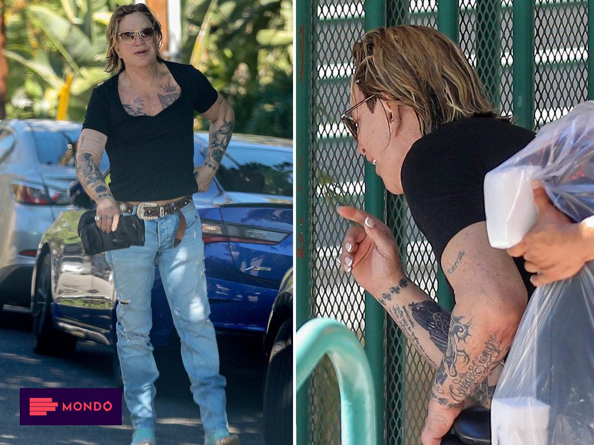 miki rurk nakon operacija | Magazin | Lifestyle