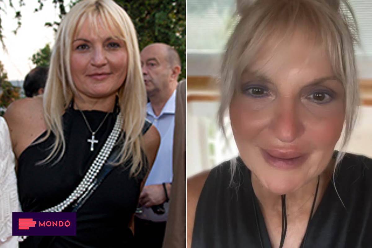 Vesna Da Vinča ujed ose | Magazin | Zvijezde i tračevi