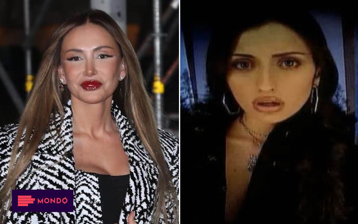 emina jahović prije i posle plastičnih operacija | Magazin | Zvijezde i tračevi