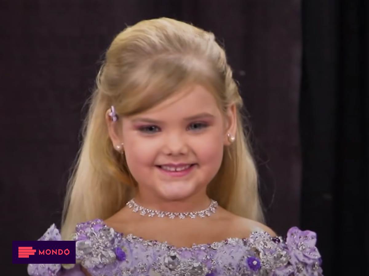 Eden Vud najljepša djevojčica na svijetu je punoljetna | Magazin ...